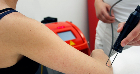 Epicondylitis: laser treatment for tennis elbow | ASA Laser